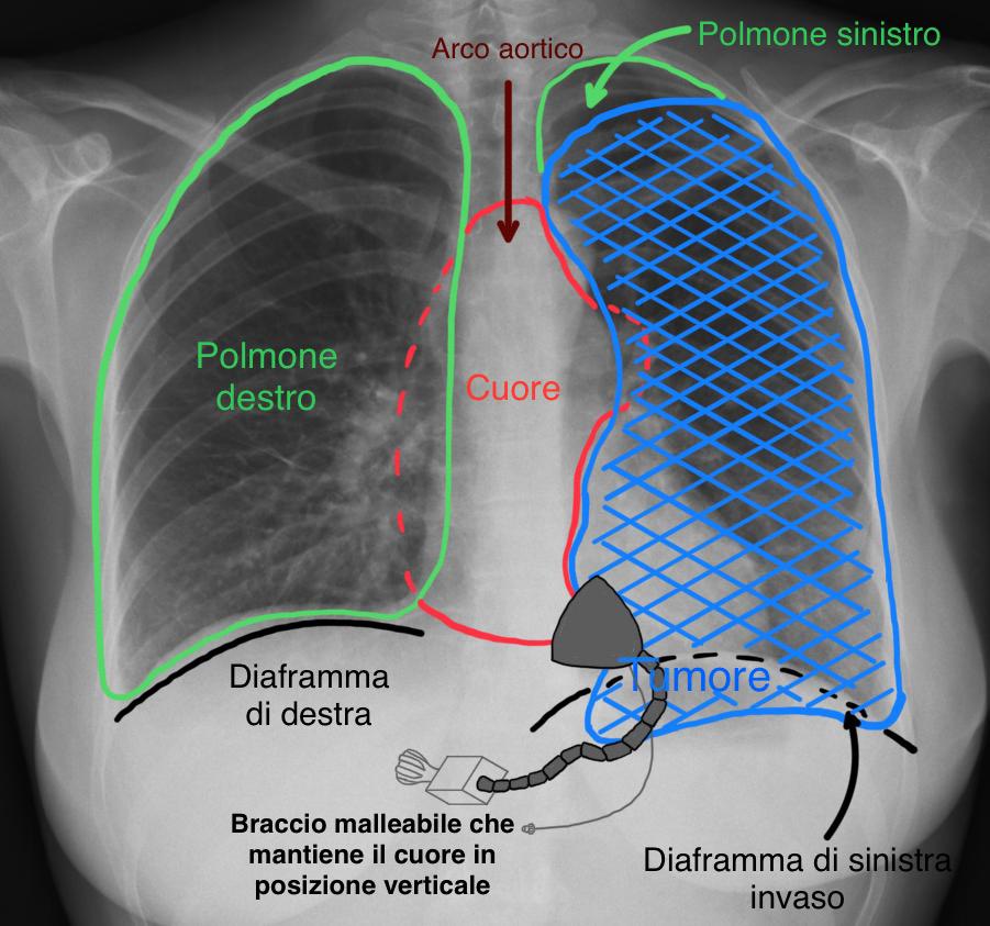 Un bacio Un bacio